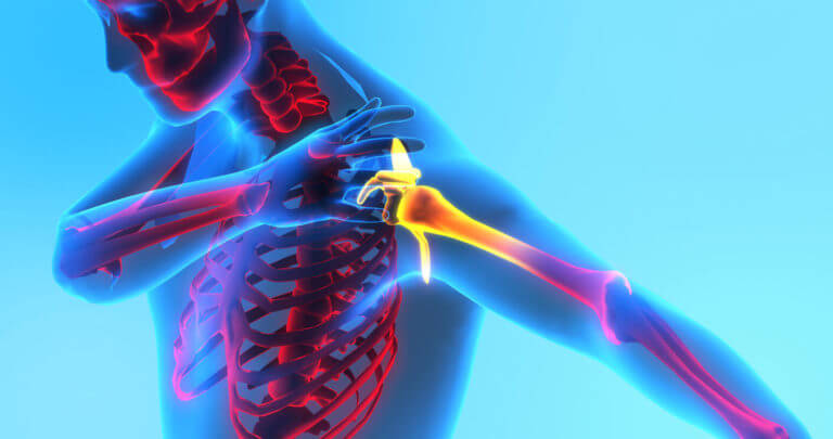 Shoulder Replacement Surgery Vs. Minimally Invasive Treatments